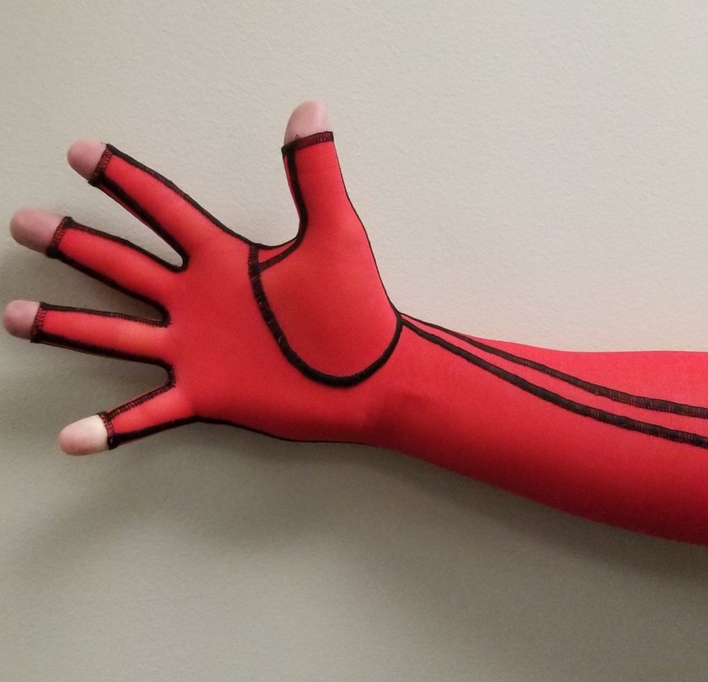 Burn Pressure Garments by Compression Management Services